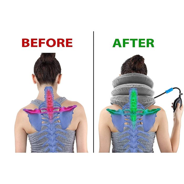 Cervical Neck Traction Device