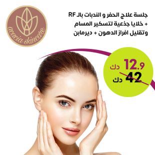 Rf Scar And Pit Treatment Session + Stem Cells To Close Pores And ...